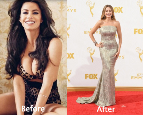 Sofia Vergara Plastic Surgery Before and After Photos