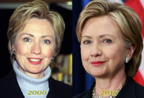 Hillary Clinton Plastic Surgery Before and After Photos