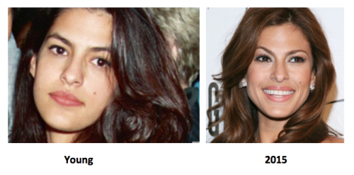 Eva Mendes Plastic Surgery Before and After Photos