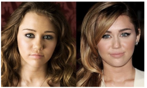Miley Cyrus Plastic Surgery Before and After Pictures