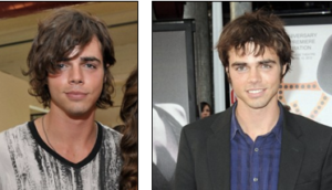 Reid Ewing Plastic Surgery Before and After - Regrets