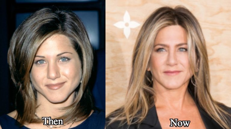 Jennifer Aniston sharp chin surgery before and after - Latest Plastic ...