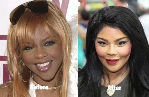Lil Kim Plastic Surgery with Before and After Photos