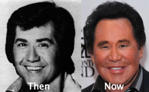 Wayne Newton Plastic Surgery Gone Wrong - Latest Plastic Surgery Gossip ...
