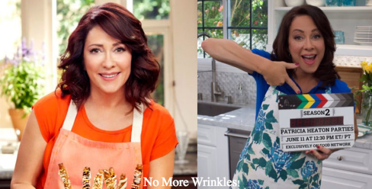 Patricia Heaton Plastic Surgery Before and After Photos