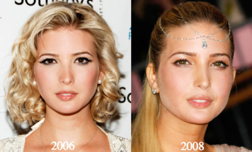 Ivanka Trump Plastic Surgery Before and After Photos