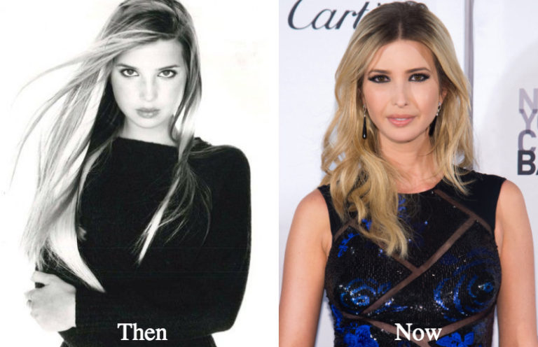 Ivanka Trump Plastic Surgery Before and After Photos