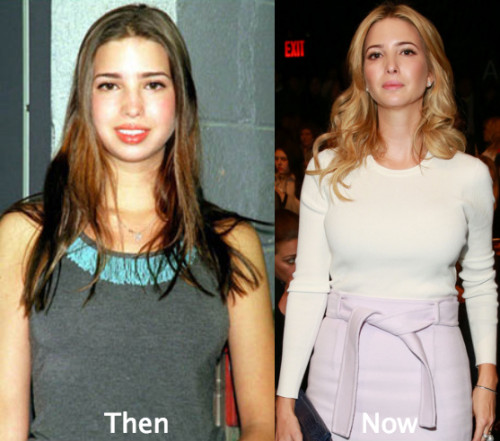 Ivanka Trump Plastic Surgery Before and After Photos