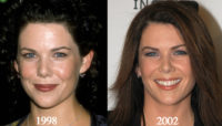 Lauren Graham Plastic Surgery Before and After Photos