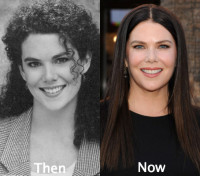 Lauren Graham Plastic Surgery Before and After Photos