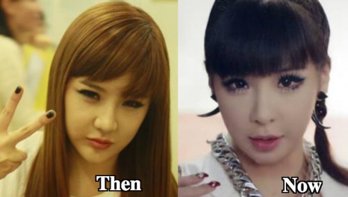 Park Bom Plastic Surgery Before and After Photos