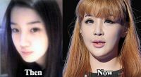 Park Bom Plastic Surgery Before and After Photos