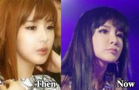 Park Bom Plastic Surgery Before and After Photos