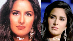 Katrina Kaif Plastic Surgery Before and After Photos