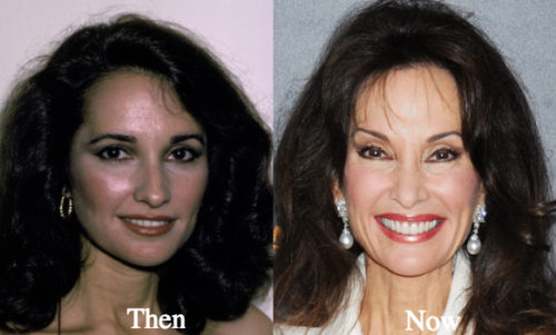 Susan Lucci Plastic Surgery Before and After Photos