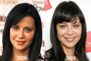 Catherine Bell Plastic Surgery Before and After Photos - Latest Plastic ...