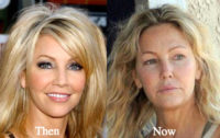 Heather Locklear facelift - Latest Plastic Surgery Gossip And News ...