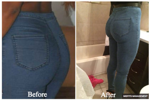 Lateysha Grace butt implants before and after - Latest Plastic Surgery ...
