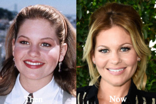 Candace Cameron Plastic Surgery Before and After Photos - Latest ...