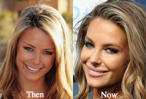 Jennifer Hawkins Plastic Surgery Before and After Photos - Latest ...