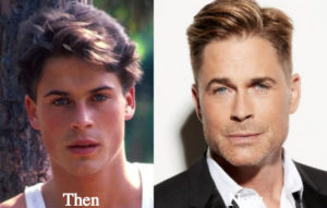 Rob Lowe Plastic Surgery Before and After Photos - Latest Plastic ...