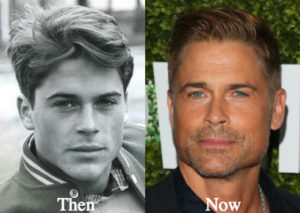 Rob Lowe Plastic Surgery Before and After Photos - Latest Plastic ...