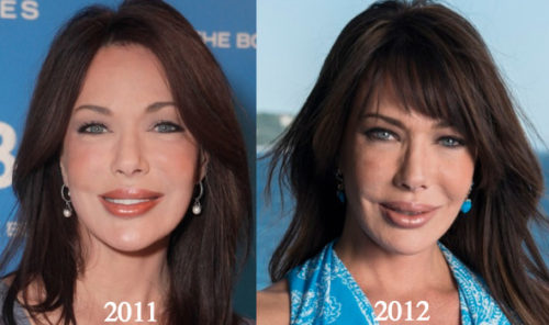 Hunter Tylo Plastic Surgery Before and After Photos - Latest Plastic ...