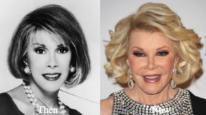 Joan Rivers Plastic Surgery Before and After Photos - Latest Plastic ...