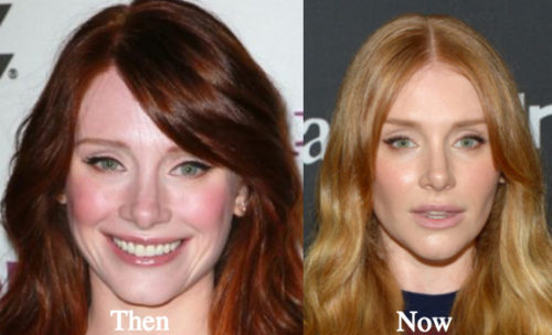 Bryce Dallas Howard Plastic Surgery Before and After Photos - Latest ...