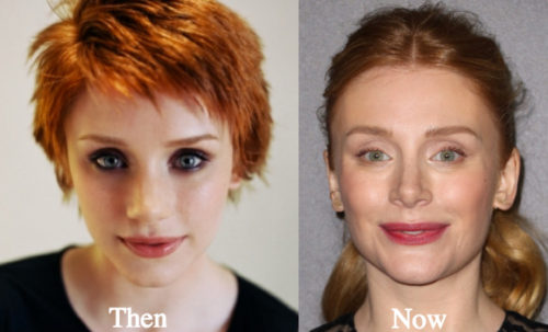 Bryce Dallas Howard Plastic Surgery Before and After Photos - Latest ...