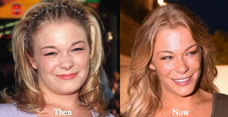 LeAnn Rimes Plastic Surgery Before and After Photos - Latest Plastic ...