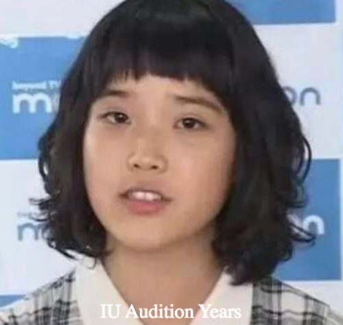 IU Plastic Surgery Before and After Photos - Latest Plastic Surgery ...