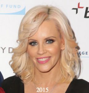 Jenny McCarthy Plastic Surgery Before and After Photos - Latest Plastic ...