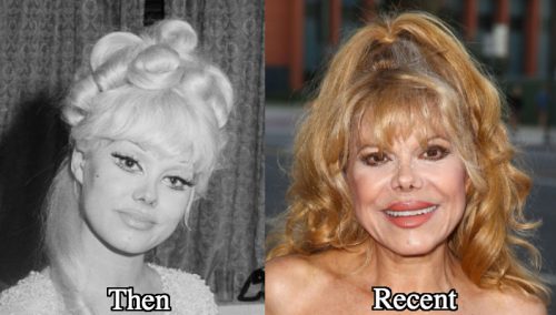 Charo Plastic Surgery Before and After Photos - Latest Plastic Surgery ...