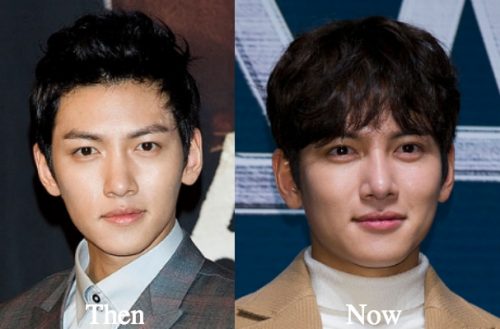 Ji Chang Wook Plastic Surgery Before and After Photos - Latest Plastic ...