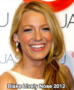 Blake Lively Nose Job Before and After Photos - Latest Plastic Surgery ...