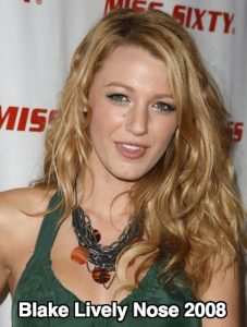 Blake Lively Nose Job Before and After Photos - Latest Plastic Surgery ...