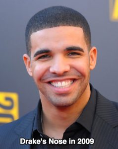 Drake Nose Job Rumors - True or False? - Latest Plastic Surgery Gossip ...
