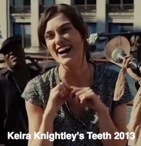 Keira Knightley Teeth Alignment - Did She Undergo teeth plastic surgery ...