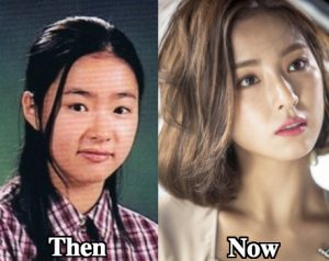Shin Se Kyung Plastic Surgery Before and After Photos - Latest Plastic ...