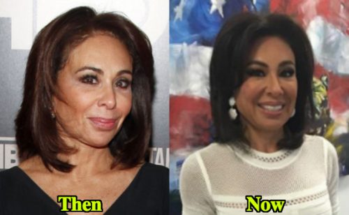 Jeanine Pirro facelift before and after - Latest Plastic Surgery Gossip ...