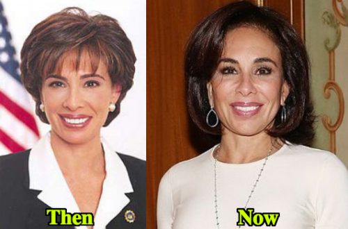Jeanine Pirro Plastic Surgery Lip Cheek Fillers Facelift Nose Job ...